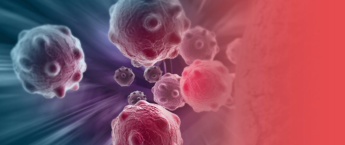 Mosunetuzumab induces complete remission in poor-prognosis non-Hodgkin ...