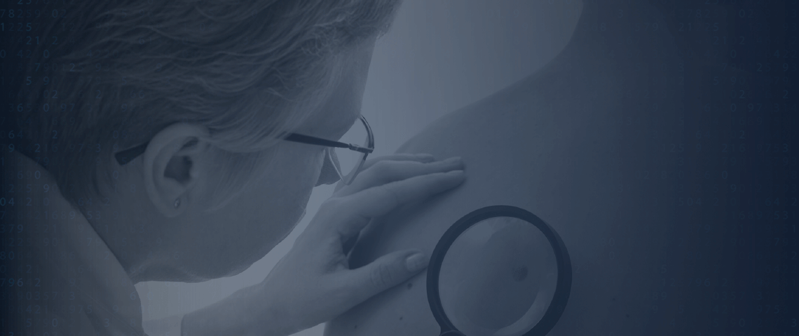 New therapeutic approaches for the most aggressive skin cancer ...